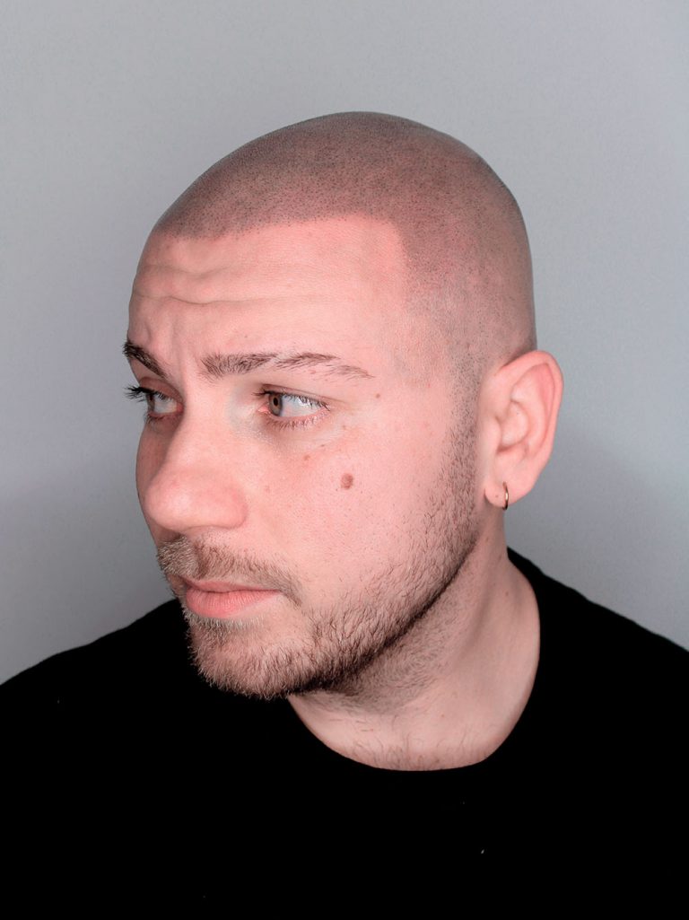 Luce un look rapado perfecto: Micropigmentación capilar para un efecto ...